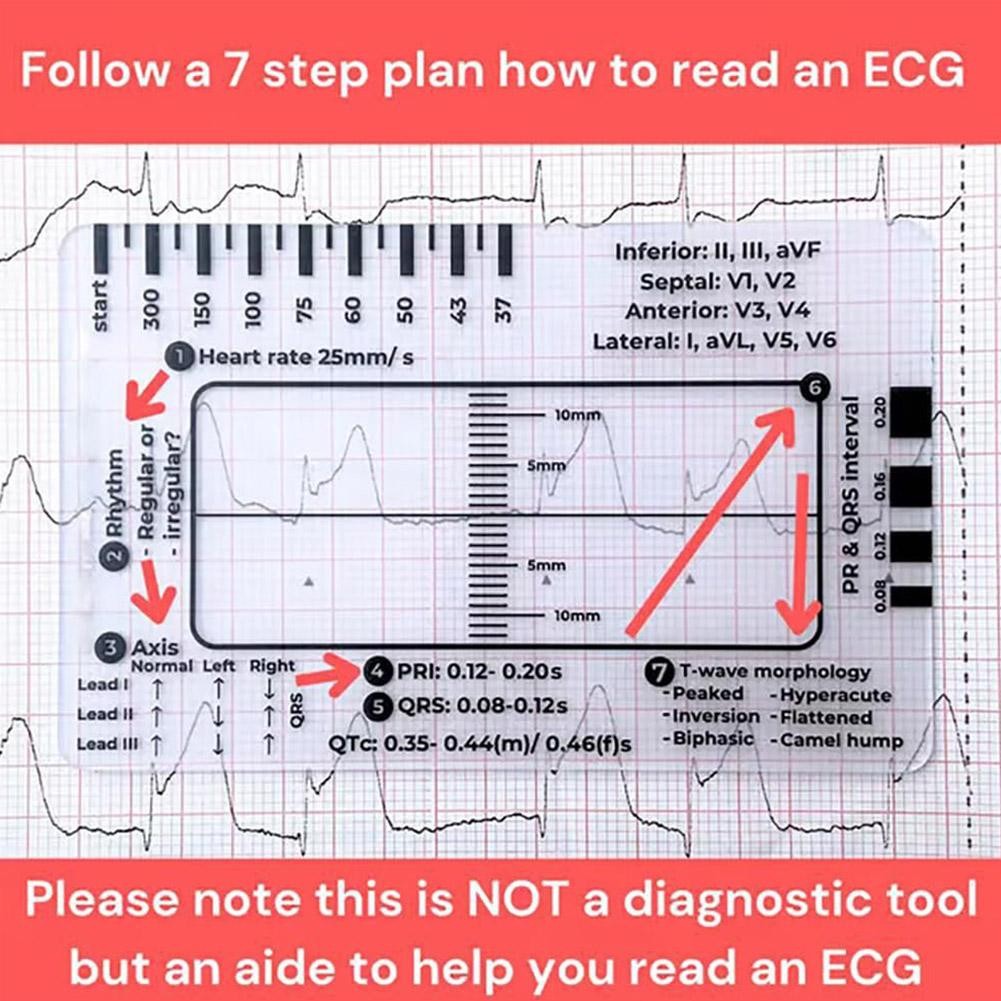 EKG PVC Badge Card – Accurately Interpret ECG/EKG Rhythm Strips ECG 7 Step Ruler | Shopee Malaysia