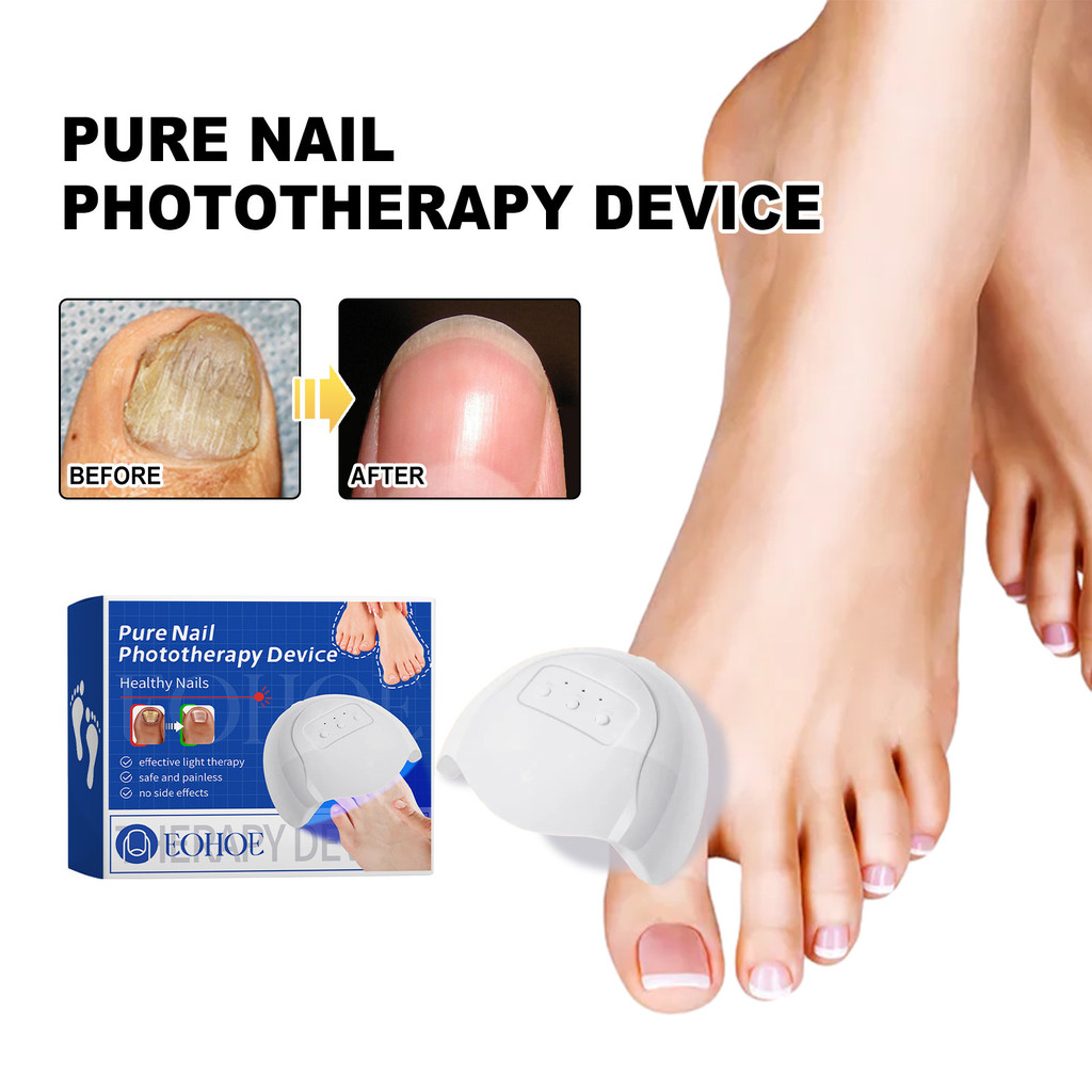 Nail Nail Care Instrument Repair Rotten Nail Ingrown Nails Toenail ...