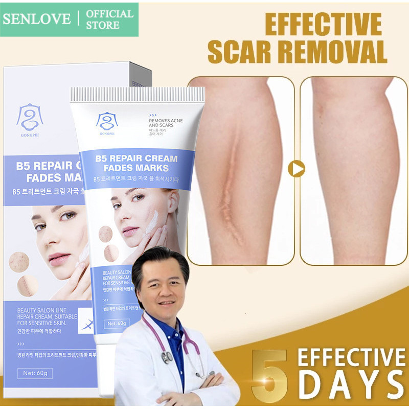 SENLOVE Scar remover cream original stretch mark acne scar remover 60g ...