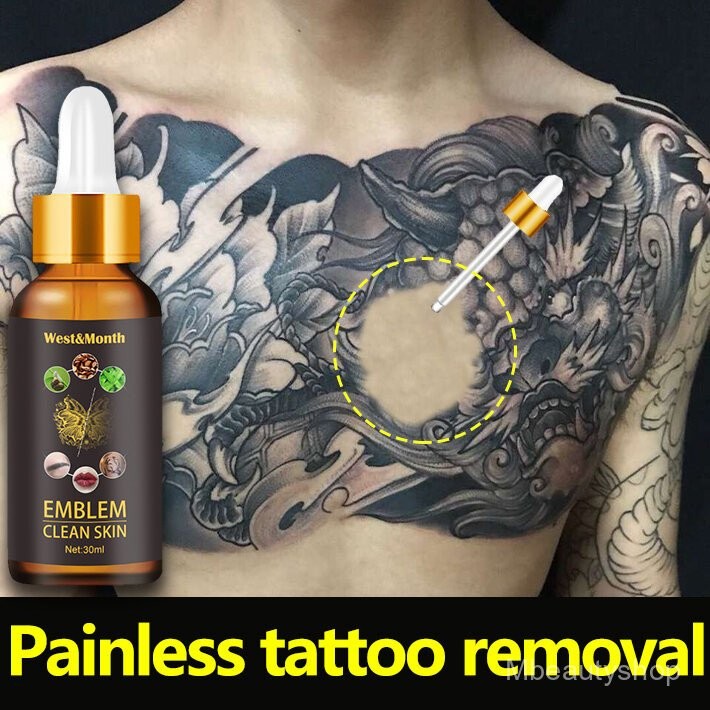 [Doctor recommended]Painless Remove Tattoo Removal Cream Tattoo Cleaner ...