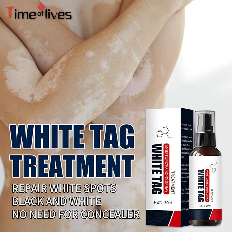 White Tag Treatment Moisturizing Spray Reduces White Spots Skin ...