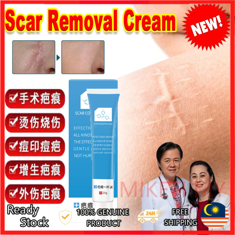 Scar Removal Cream Treatment Remove Stretch Marks Repair Acne Marks ...