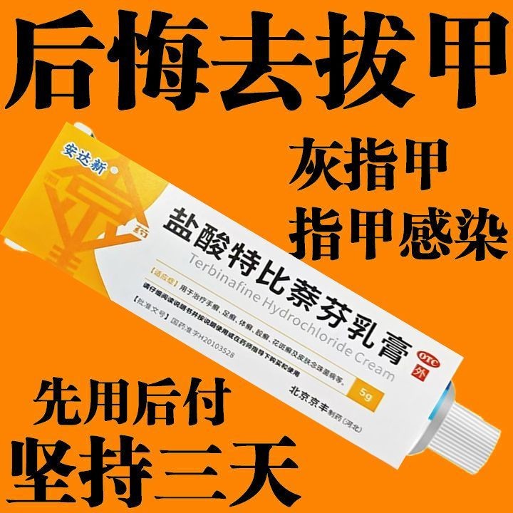 Andaxin Terbinafine Hydrochloride Cream 5g/box Severe onychomycosis ...