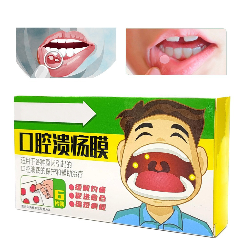 Oral Ulcers Patch 12pcs/2boxes Relief Severe Pain Irritation Canker ...