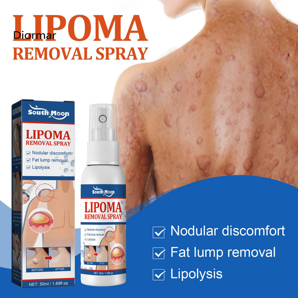 [DR] 50ml Fatty Lump Skin Care Safe Body Lipoma Removal Liquid for ...