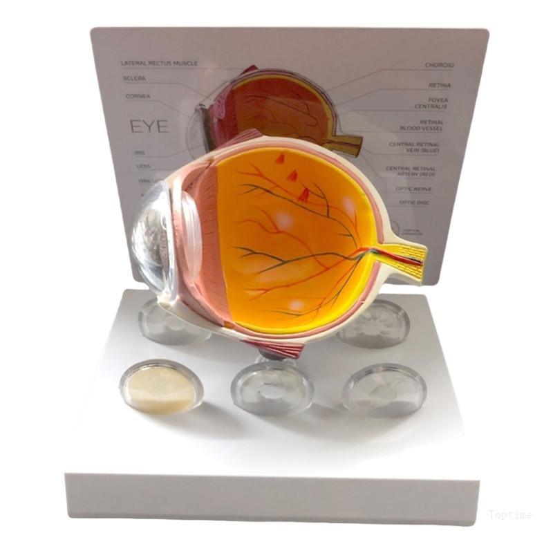 Top Human Eye Anatomy Model Anatomical Pathological Eyeball Model ...