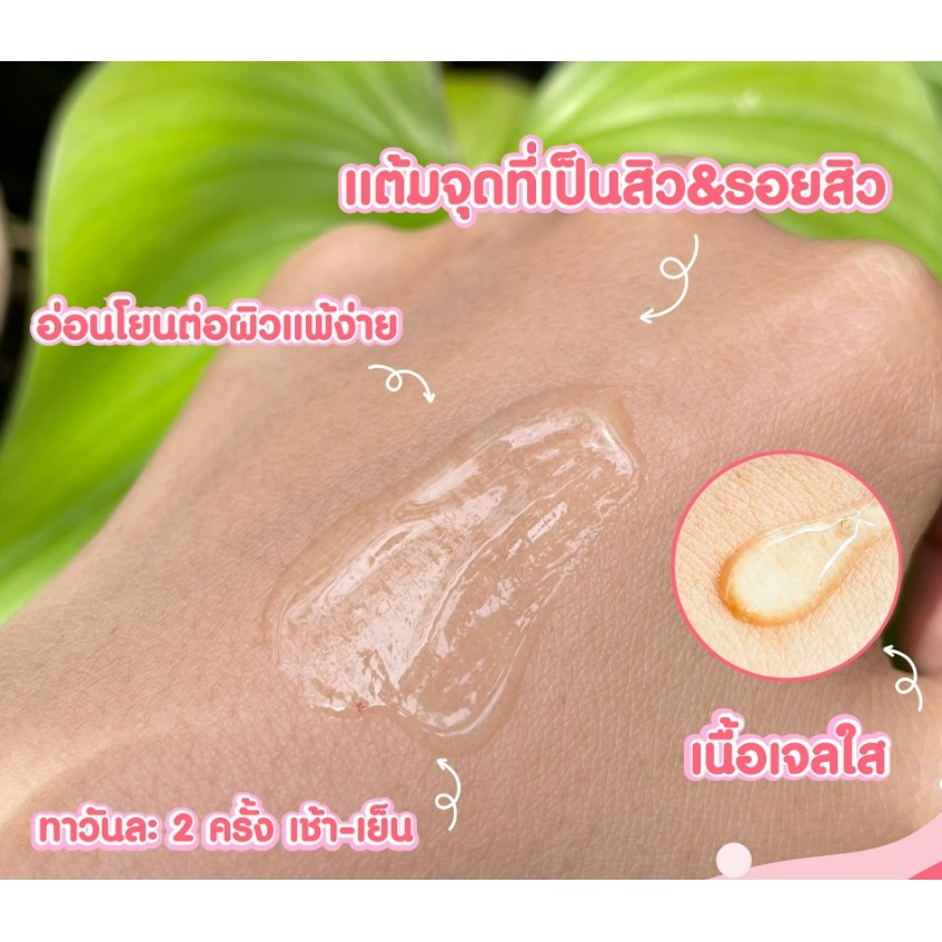 1 Sachet Dermedy Acne Gel AC Clear 5g. | Shopee Malaysia