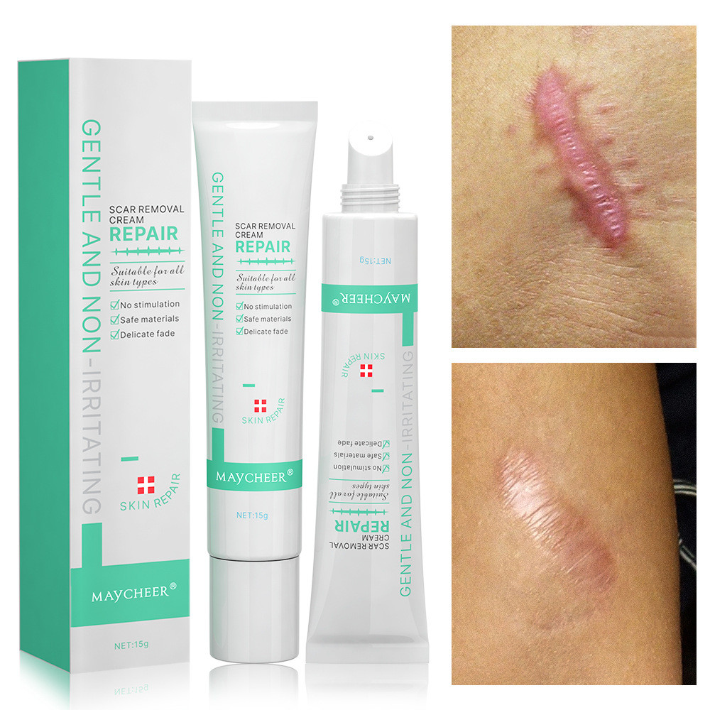 MAYCHEER Scar Removal Cream No Stimulation Delicate Fade Repair Scarred ...