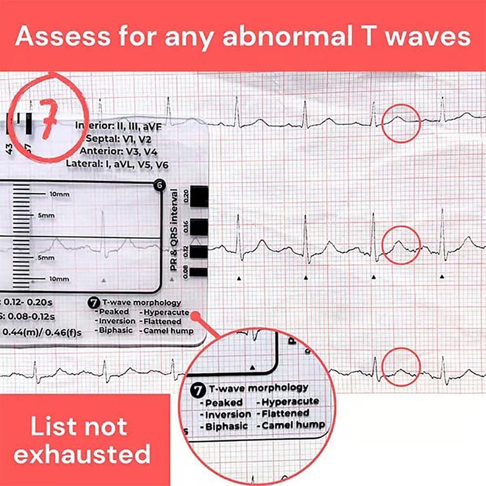 Plastic EKG Ruler Portable Ecg-interpretation Reference Guide ...