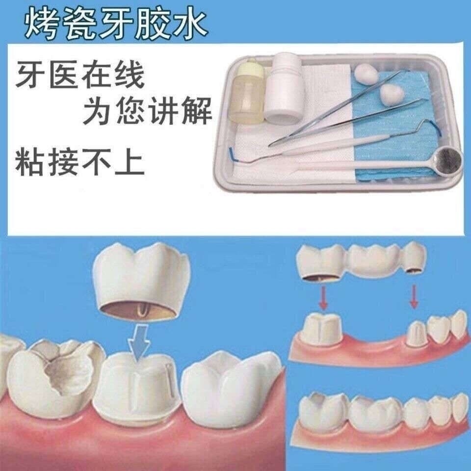 Denture Glue Do It Yourself Sticky Porcelain Teeth Glue Fixed Braces ...