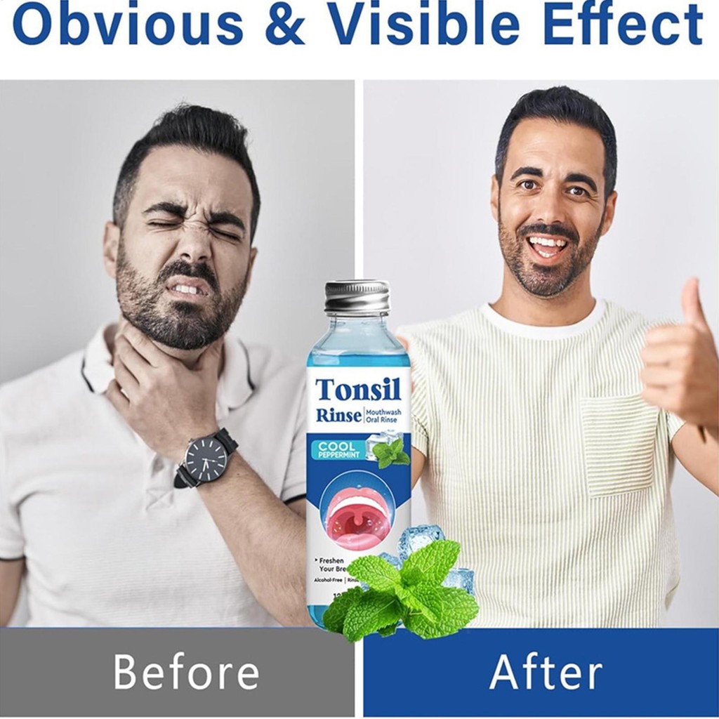Tonsil Stone Rinse Daily Oral Tonsil Mouthwash 120ml Natural Gentle ...