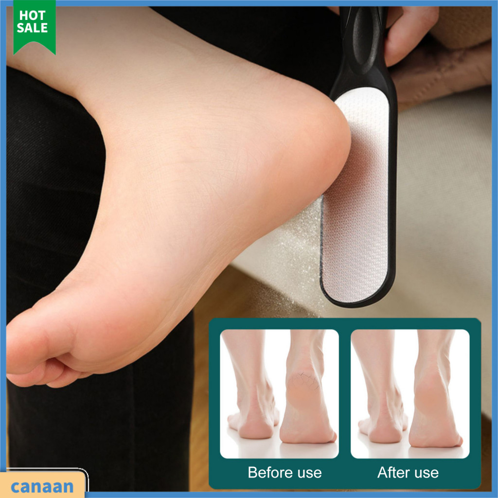 canaan| Professional Foot Scraper Stainless Steel Heel Scraper ...