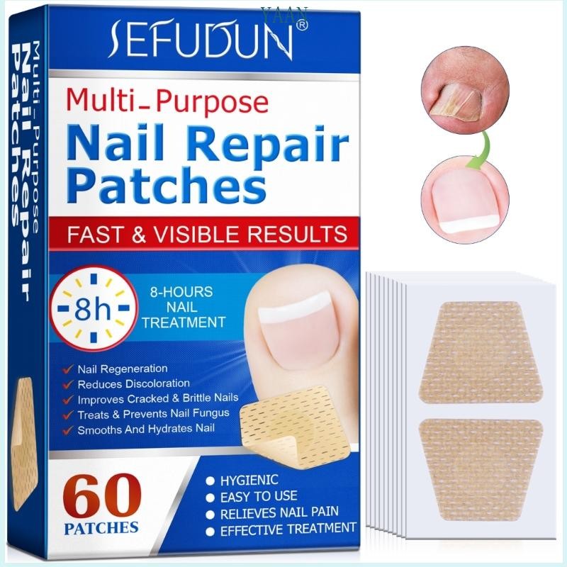 YAAN Ingrown Toenail Sticker Corrector Patches Big Toe Nail Corrector ...
