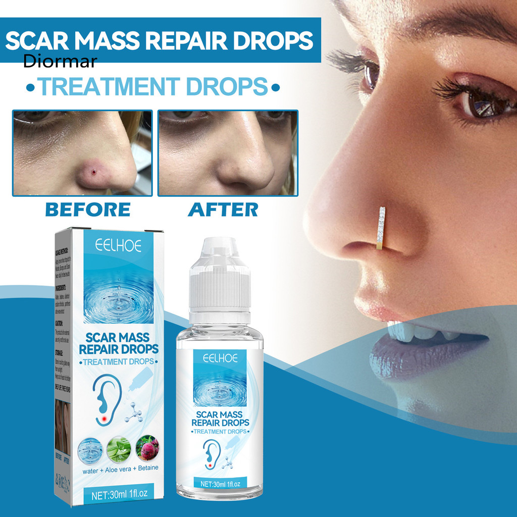 [DR] 30ml Scar Repair Agent Accelerate Cell Repair Prevent Inflammation ...