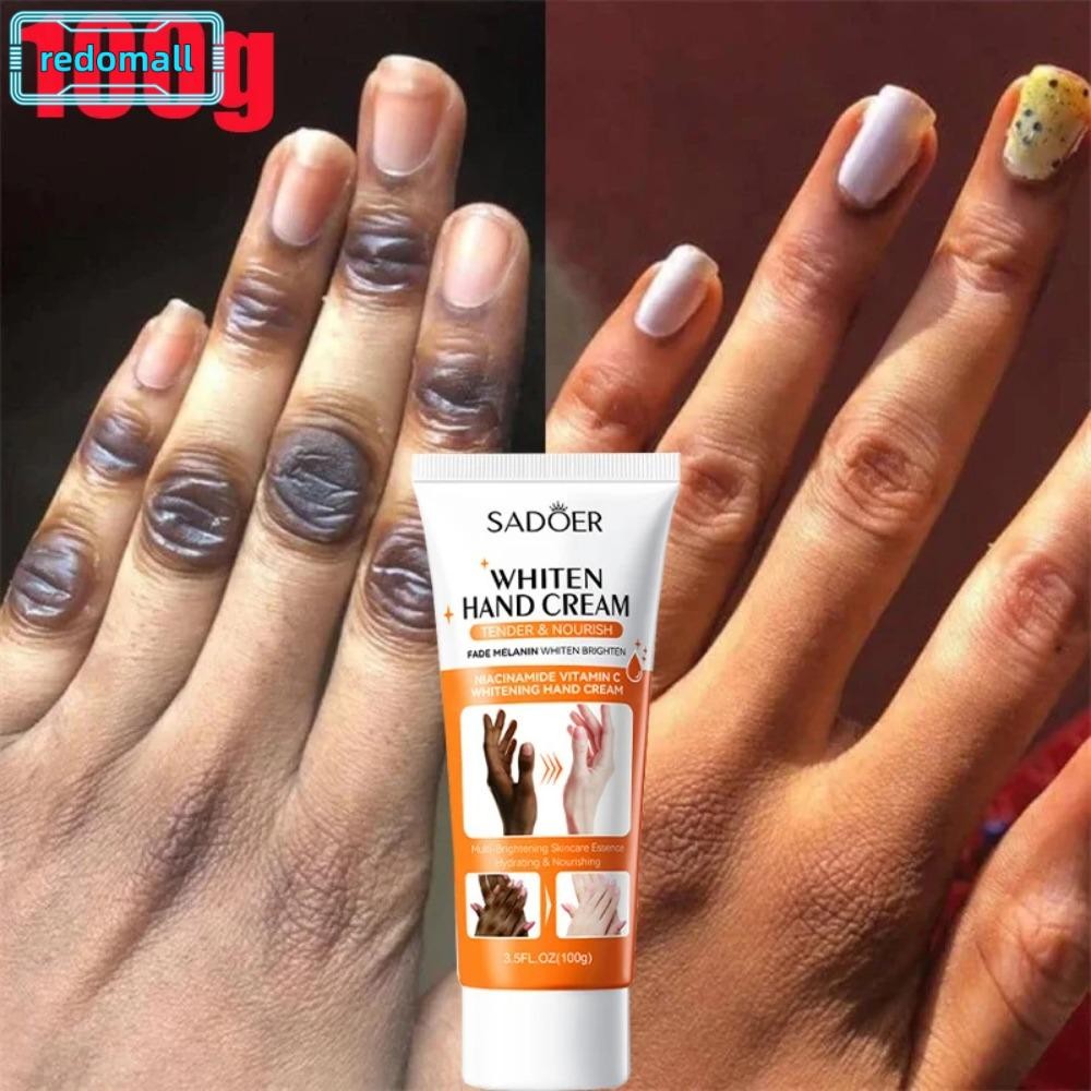 REDOMALL Hand Cream, Quickly Bleach Joint Fast Whitening Serum ...