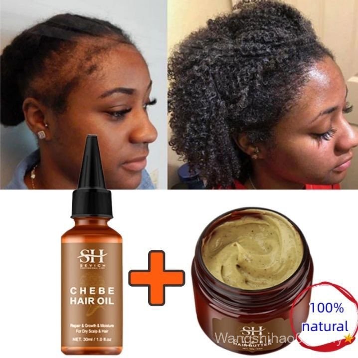 New Chebe Fast Hair Growth Traction Alopecia Hair Mask Oil | Shopee ...