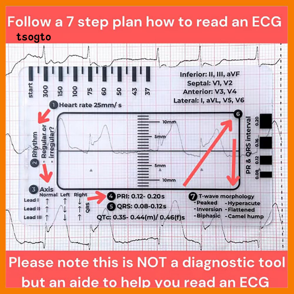[TS] Heart Rate Assessment Tool Axis Deviation Reference Guide Portable ...