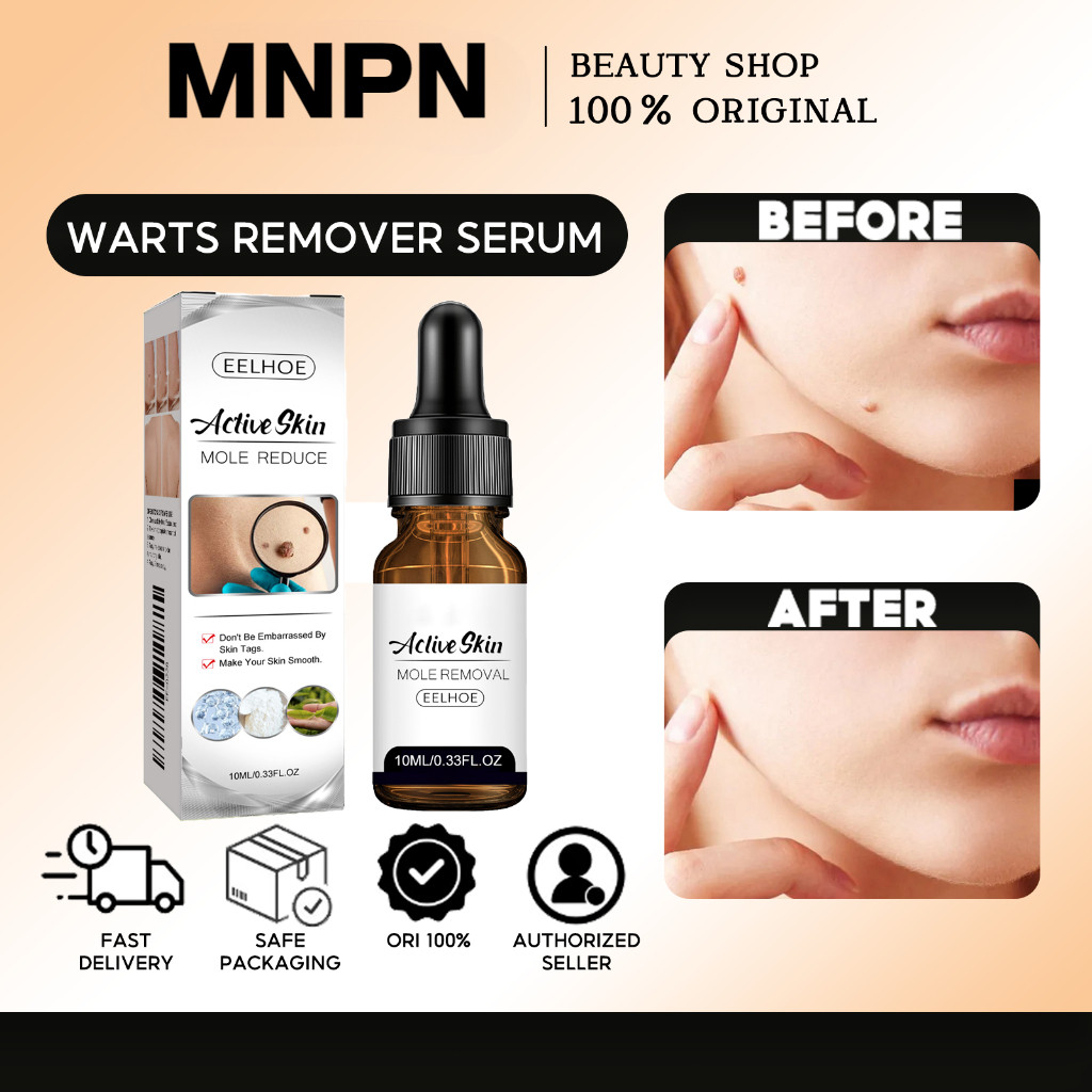 Eelhoe warts and mole Remover Serum skin tags warts and moles treatment ...