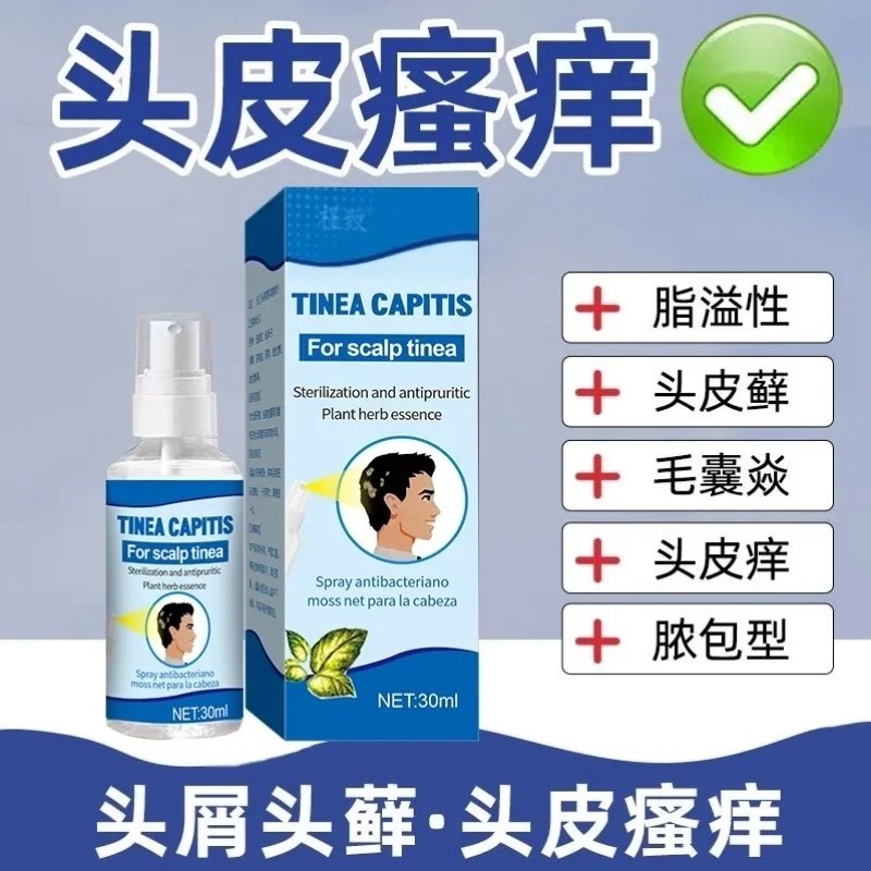 Scalpitis Overflowing Dermatititis Scalp Dandruff Anti-itching Anti ...