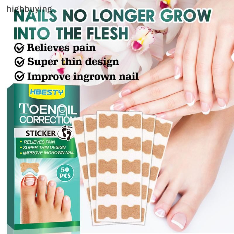 HBMY 50Pcs Ingrown Nail Correction Stickers Paronychia Treatment ...