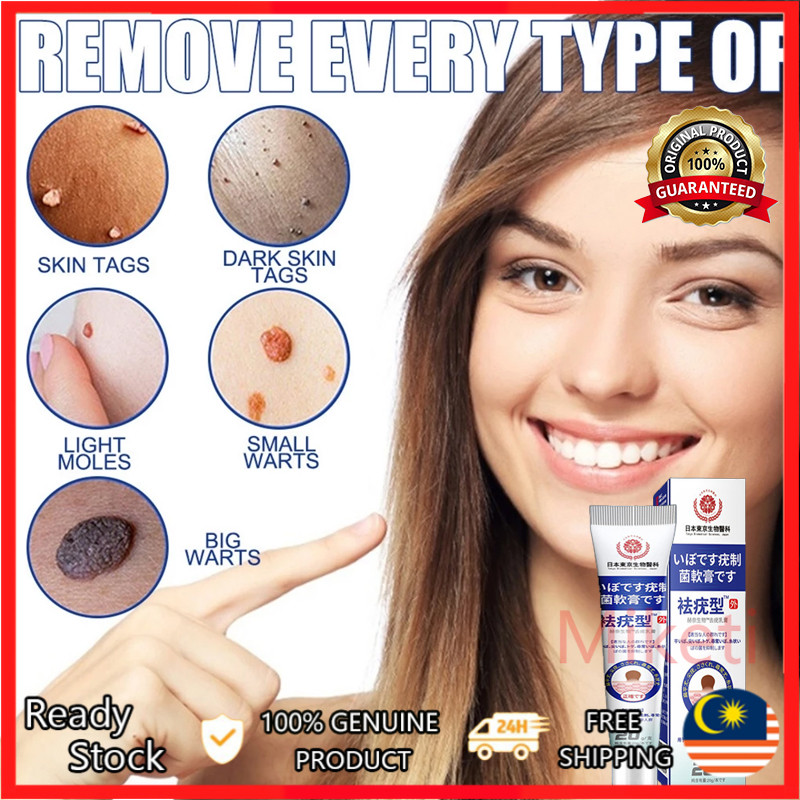 Remover Cream 20g Painless Mole Skin Dark Spot Warts Remover Serums Freckles Face Wart Tags ...