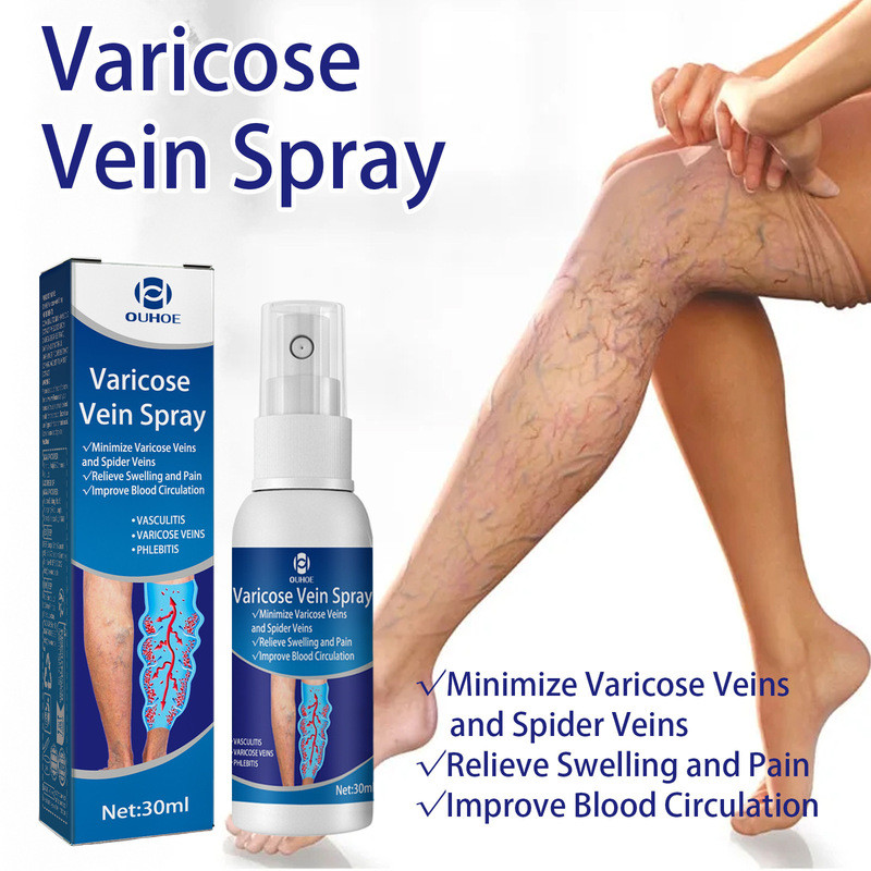 OUHOE Vein Spray Relieve Vein Care Vein Blood Vein Bulge Pain Vein ...