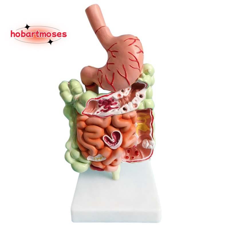 Human Digestive System Model Stomach Anatomy Large Intestine Cecum ...