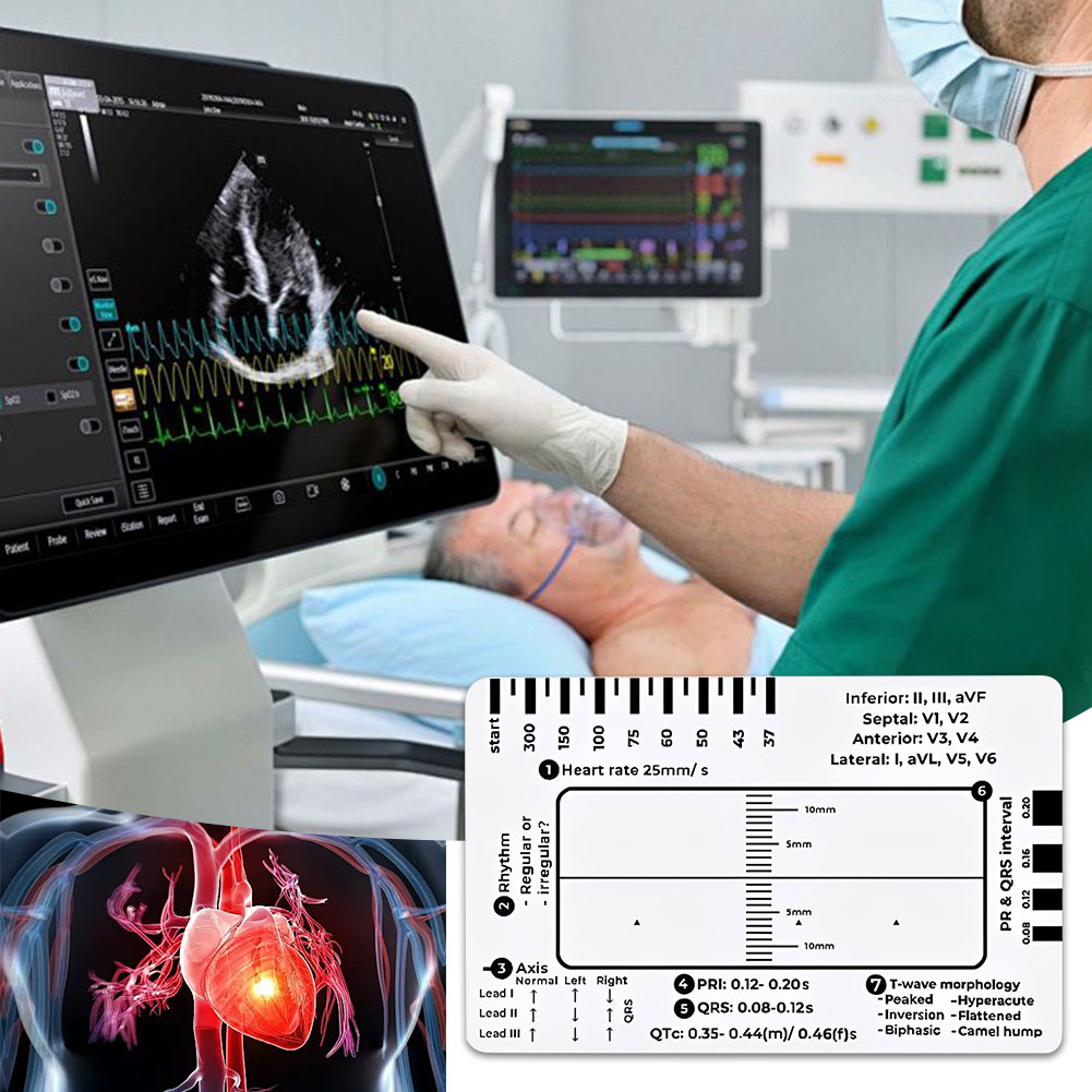 ECG 7 Step Ruler Pocket-Sized EKG Measuring Card ECG Guide Measurement Tool for ECG/EKG ...