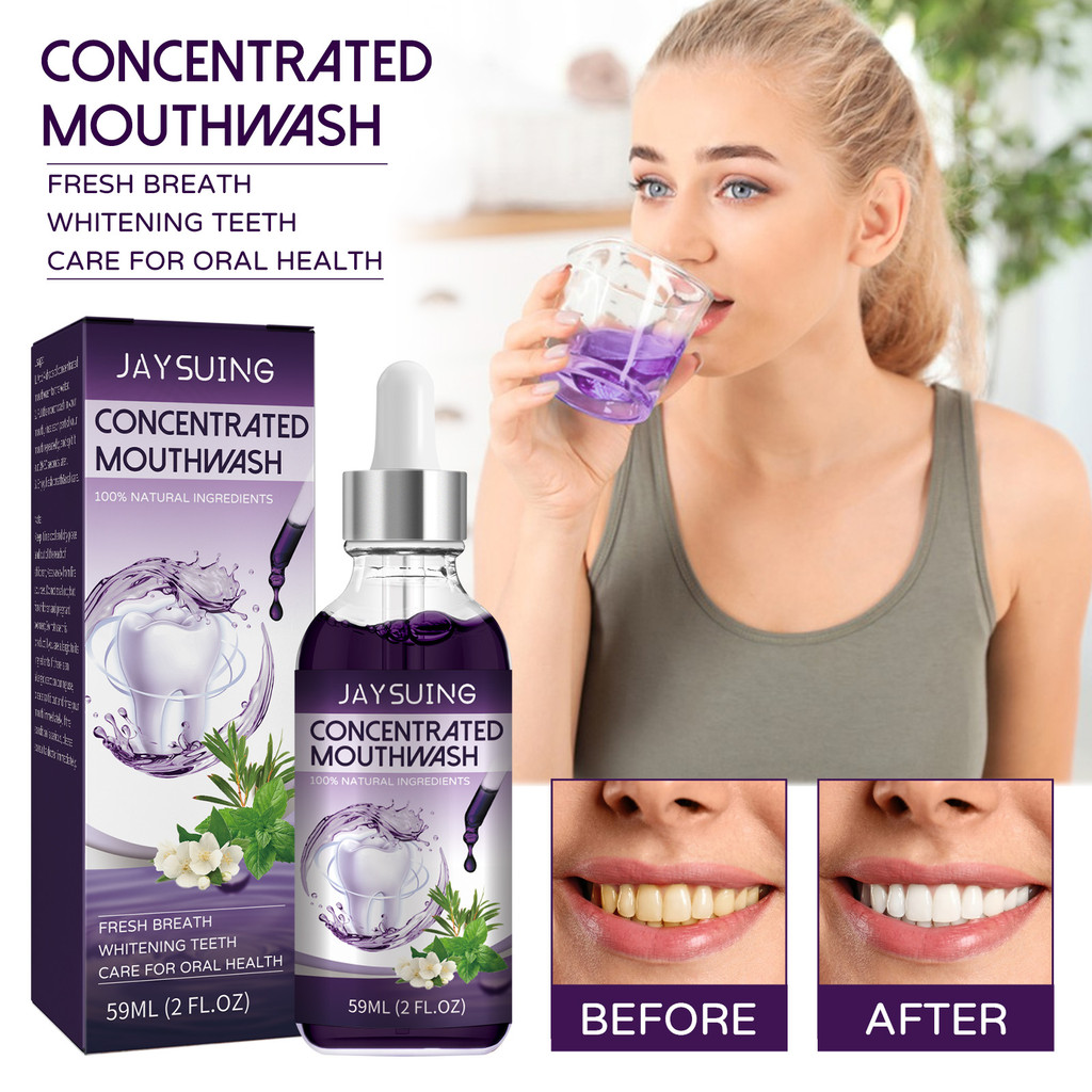 马来西亚本土发货Jaysuing Concentrated Mouthwash Clean Oral Fresh Bright White Teeth Mouthwash | Shopee ...