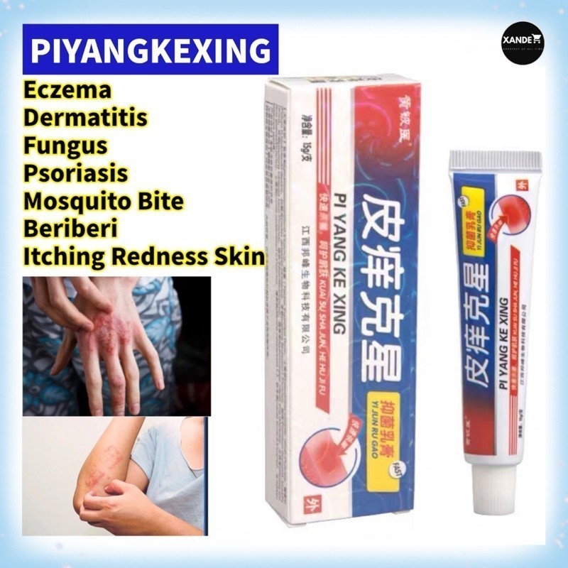 Eczema Fungal Antibacterial Antiseptic Ringworm Psoriasis Itchy Skin ...