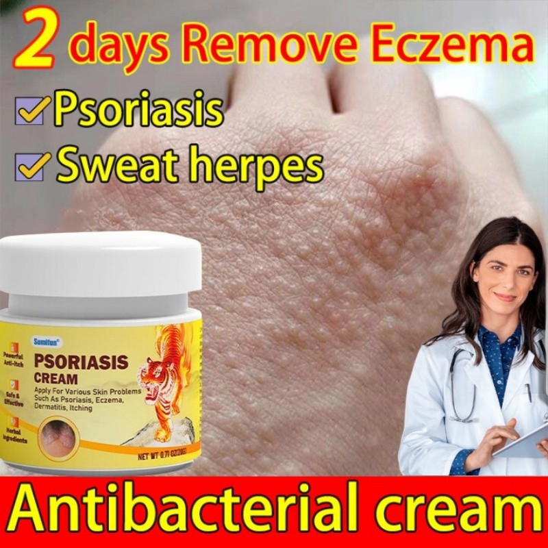 Hot Psoriasis Cream Antifungal Cream Eczema Cream Cream Gatal Kulit ...