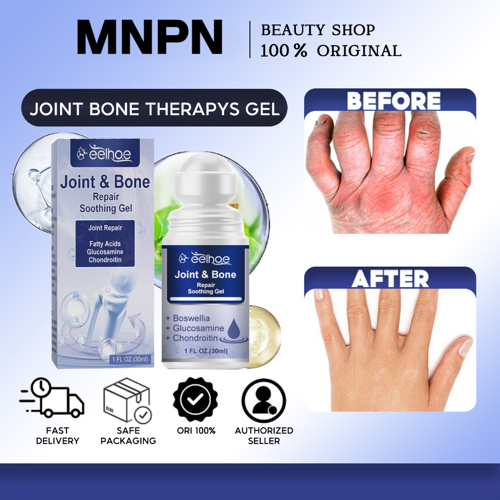 【BUY 1 GET 1】EELHOE Joint Bone Therapys Gel 30ml/Jointment cream Joint ...