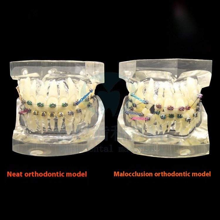 Dental Malocclusion Correction Display Model Wire Tie Bracket ...