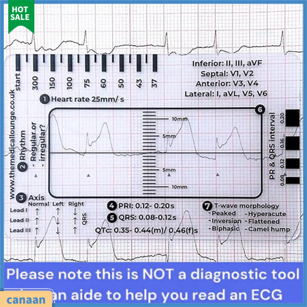 canaan| Ekg Interpretation Tool Ekg Interval Measurement Card ...