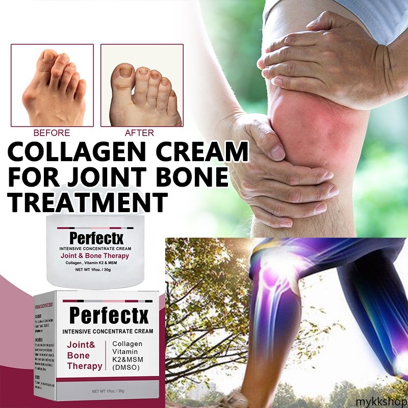 Perfectx Joint And Bone Therapy Cream Treatment Gout Cream Joint Knee ...