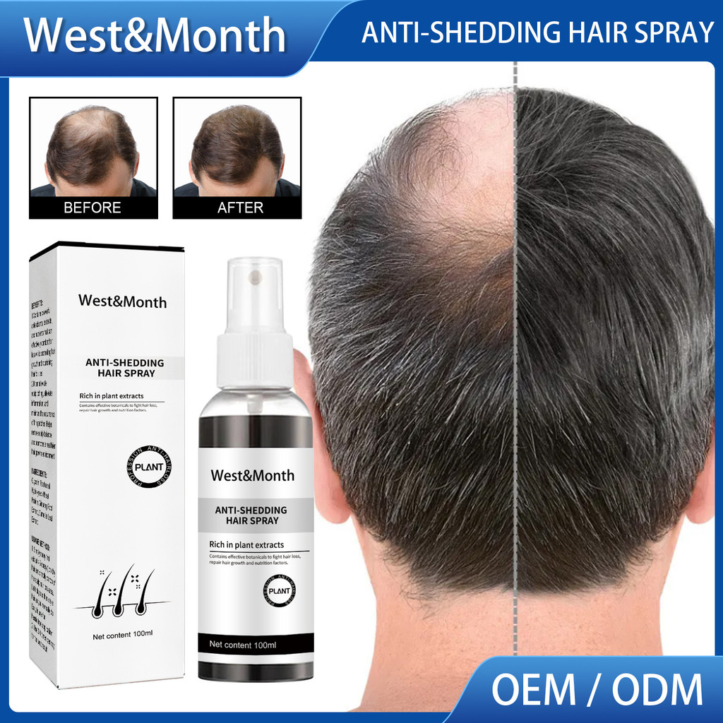 Hot Product#West & Month Anti-Hair Loss Spray Improves Hairline Dense ...