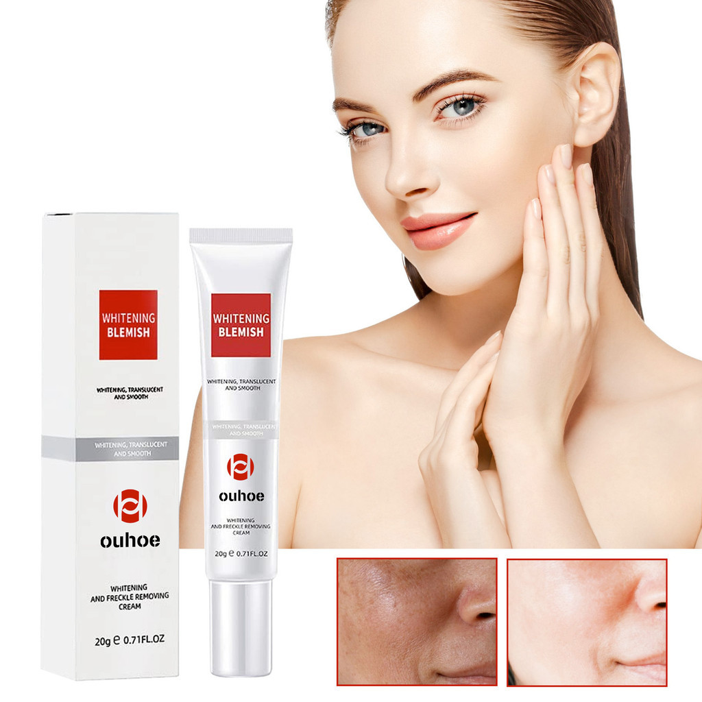 OUHOE Freckle Removal Cream 20g Effective Melasma Cream Pekas Remover ...