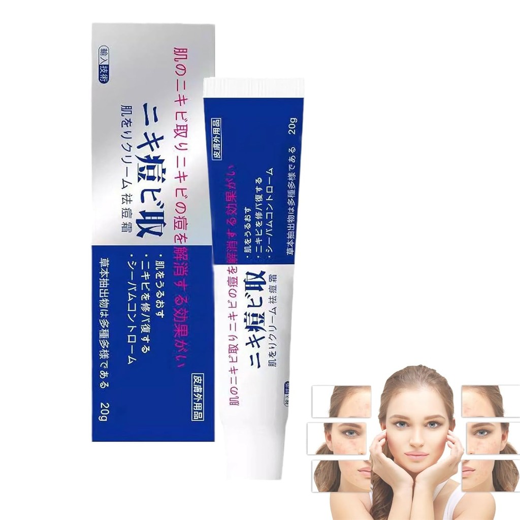 Lion Pair Acne Cream, 20g Pair Acne Cream Japan, Lion Acne Cream ...