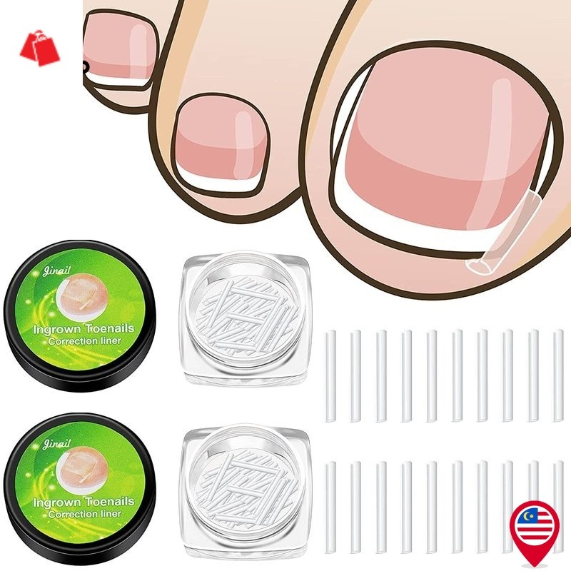 BK-10 Pcs Ingrown Toenail Corrector/ Curved Toe Straightening Patches ...