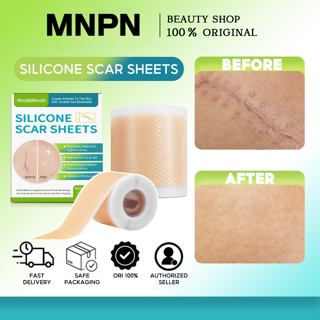 West & month silicone scar sheets patch/reusable silicone scar strips ...