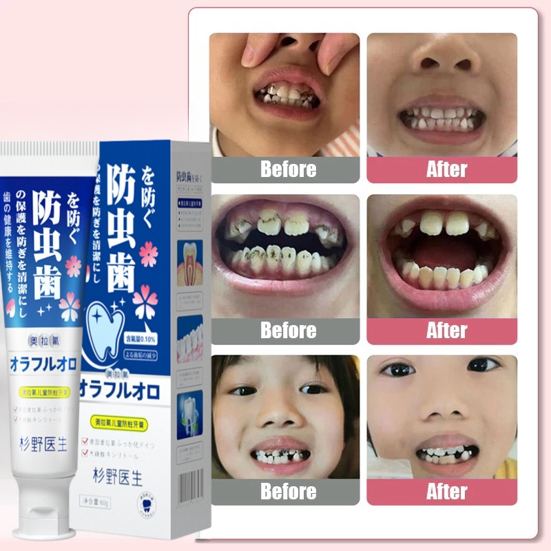 Ubat Gigi Pepejal Anti-Moth Plak Gelap Rongga Gigi Fluorida Gigi Bayi ...