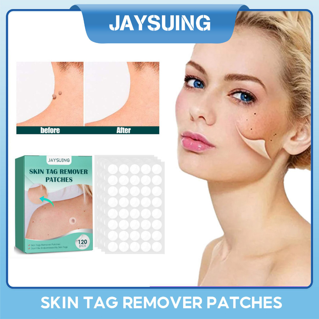 Jaysuing Skin Tag Removal Patch 120Pcs Warts Remover Plaster Buang Tahi ...