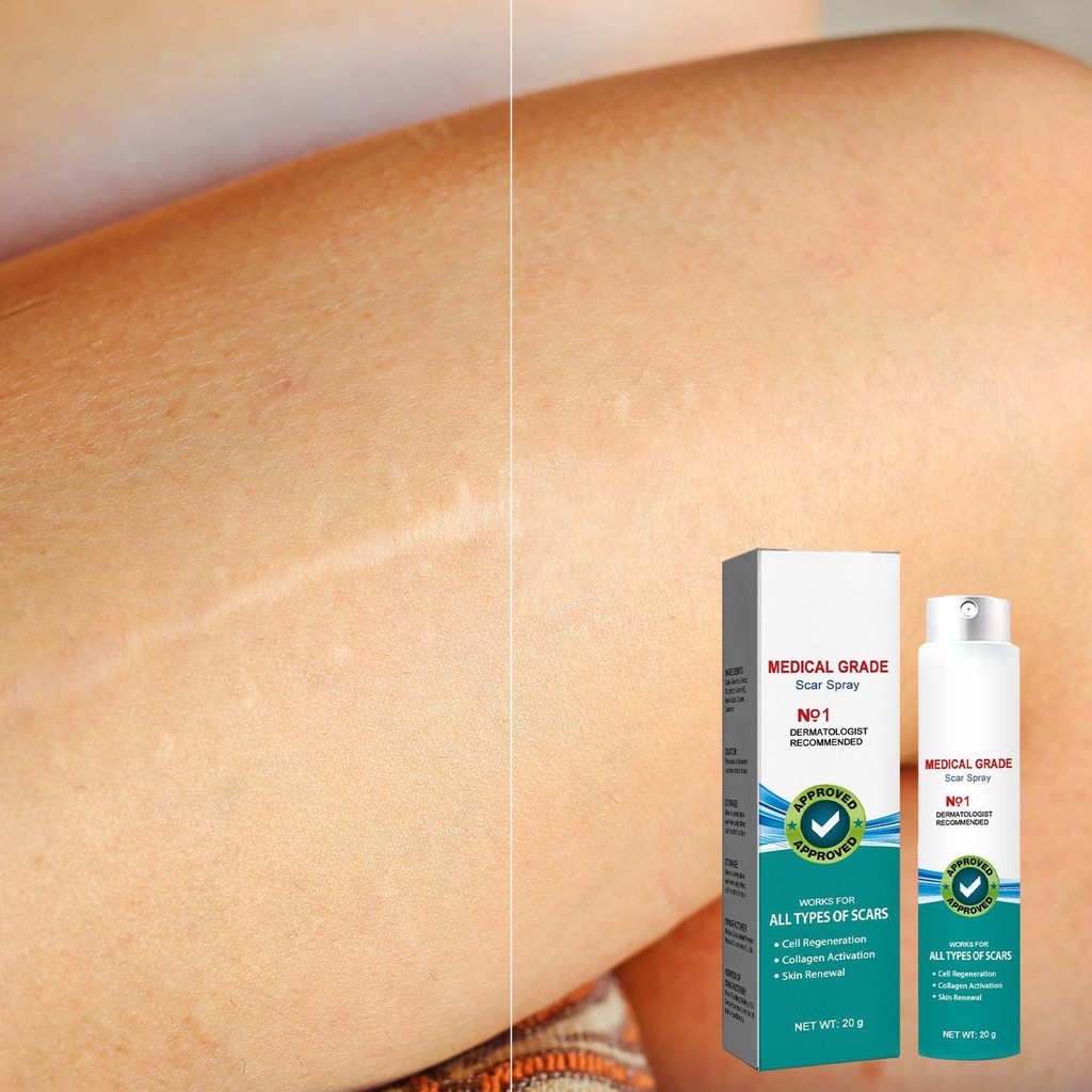 Advanced Scar Pregnant Women Stretch Mark Body Scar Repair for Scars from Injuries Surgeries ...
