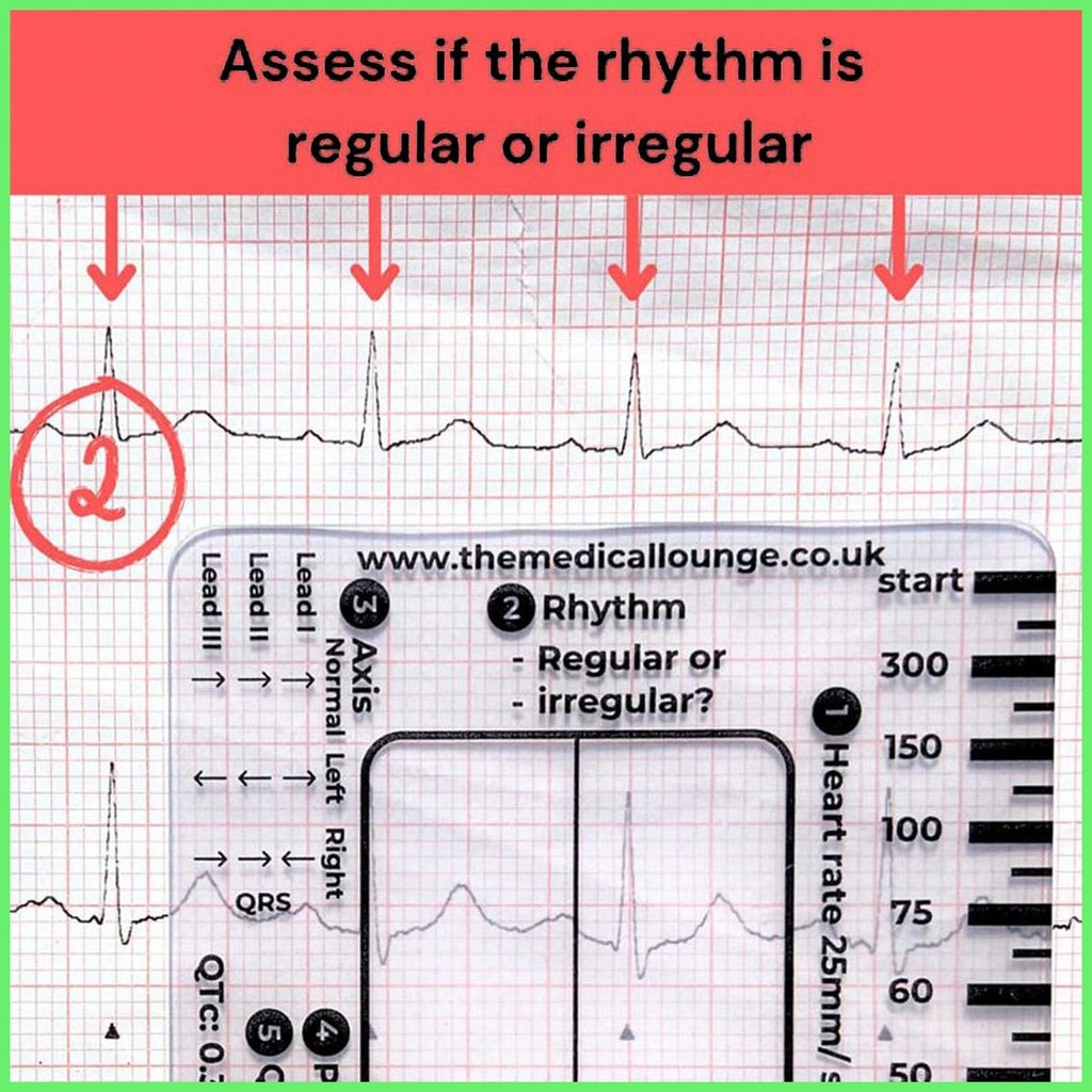 7 Step Scale For ECG Transparent ECG Caliper Measurement Clip ...