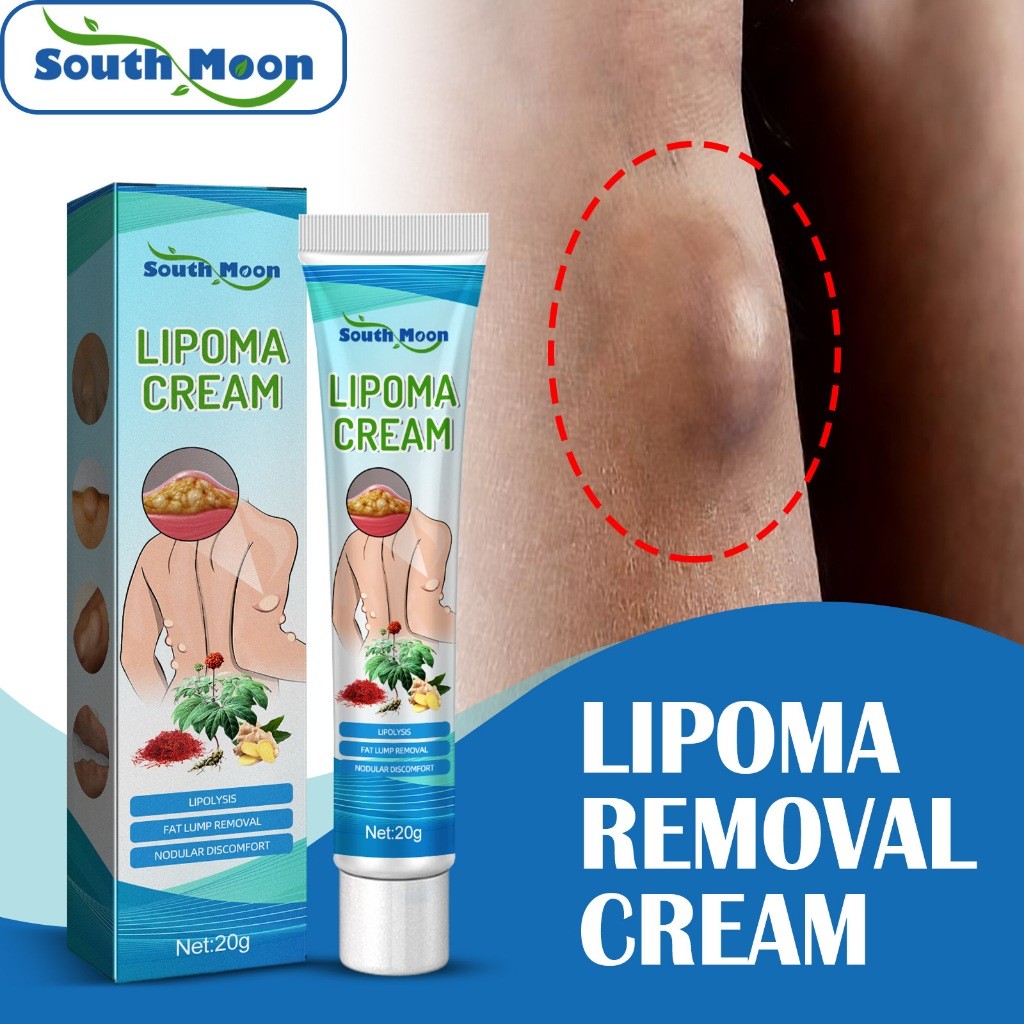 South Moon Lipoma Removal Cream 20g Herbal Formula Relieves ...
