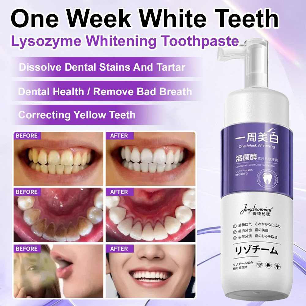 🦷Quickly Whiten Your Teeth🦷【1 Week Whitening】 Enzymes Whitening ...