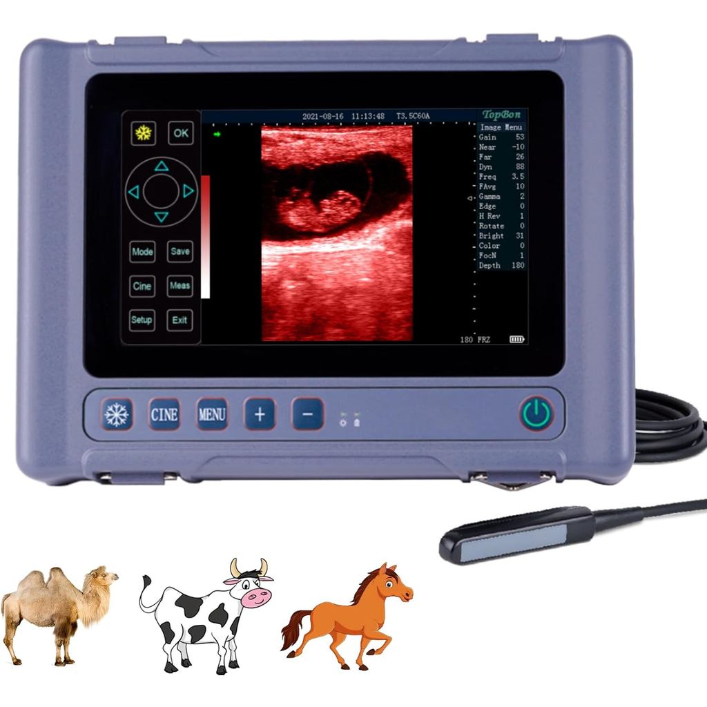 T1 Portable Pregnancy Test Ultrasound Machine 8-Inch Touch Screen ...