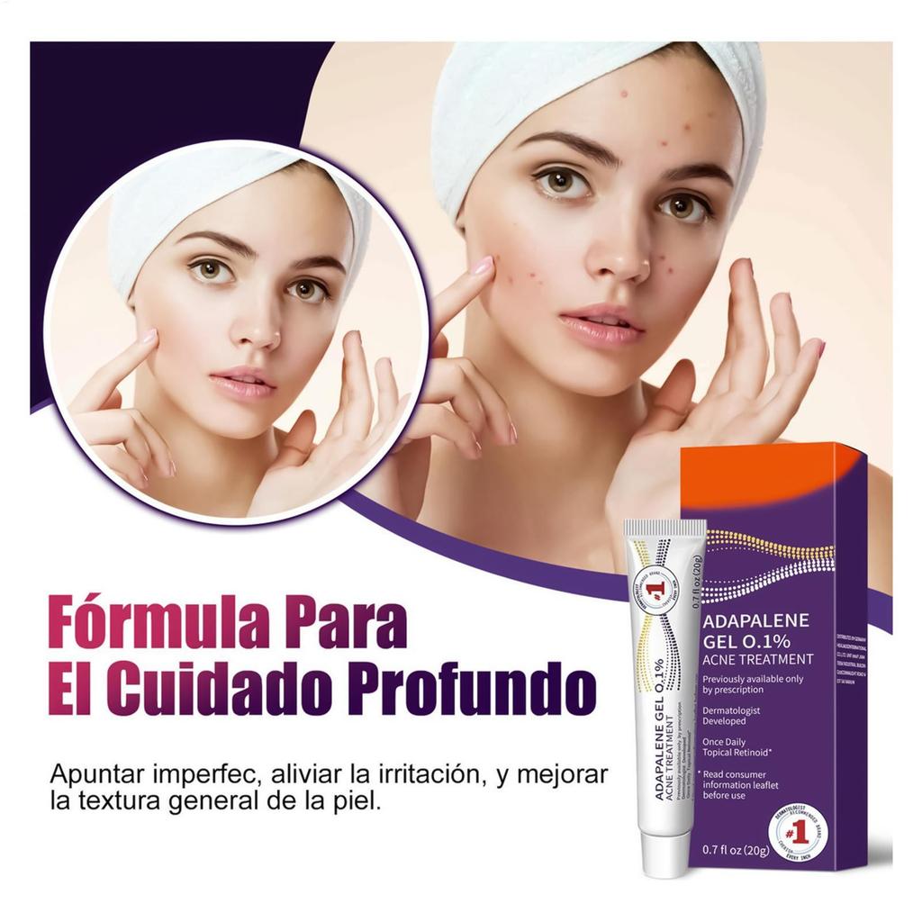 Adapalene Acne Gel Spot Scar Fade Cream Moisturizing and Gentle on Acne ...