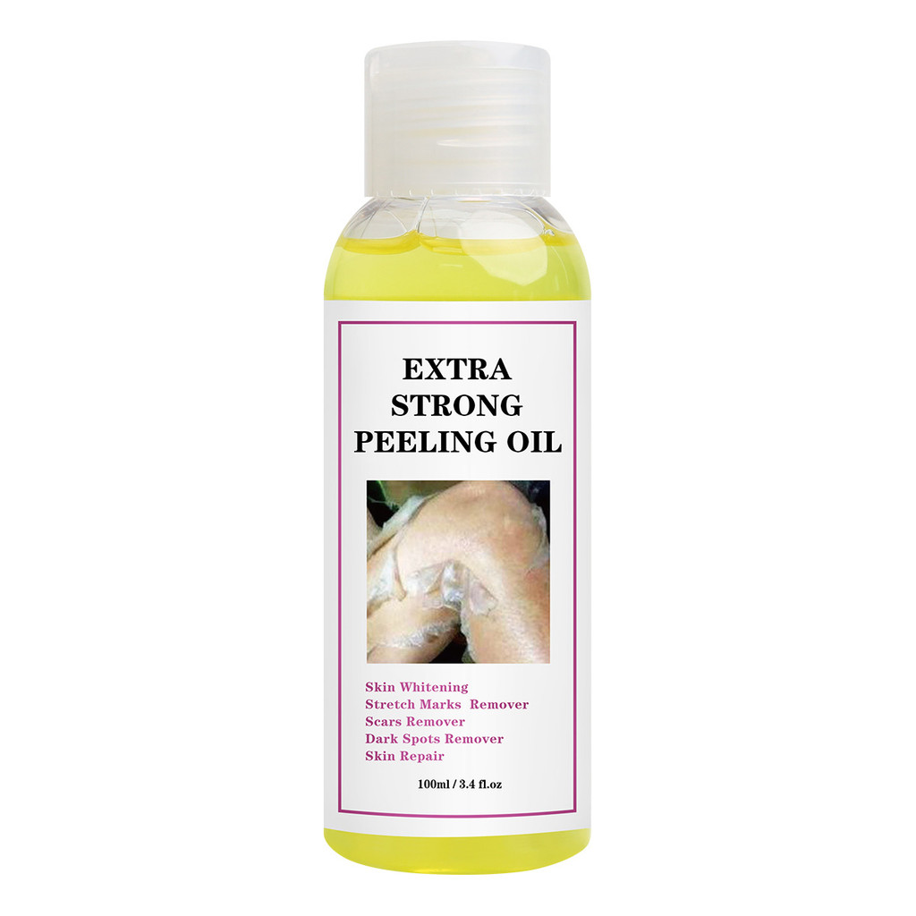 [Ready Stock] Super strong peel oil Body Lotion Peeling oil Dark Skin ...
