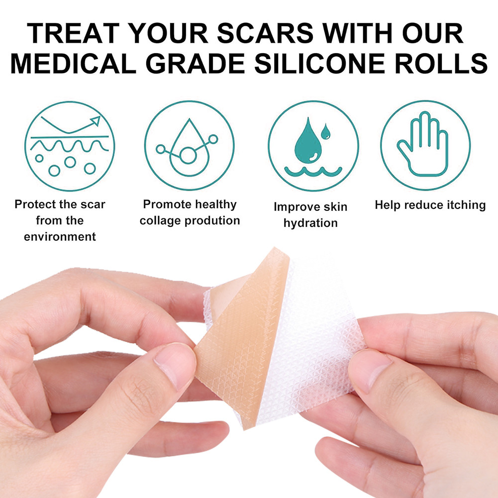 LOV Silicone Scar Sheets Keloid Removal Strip Effective Scar Reducing ...